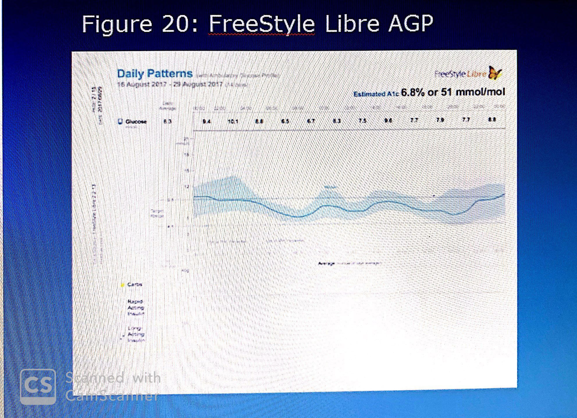AGP|CGM|See more..to judge better