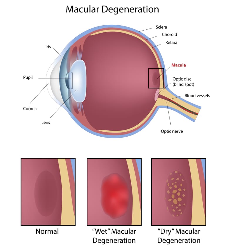Medical Retina - Visalia Eye Center